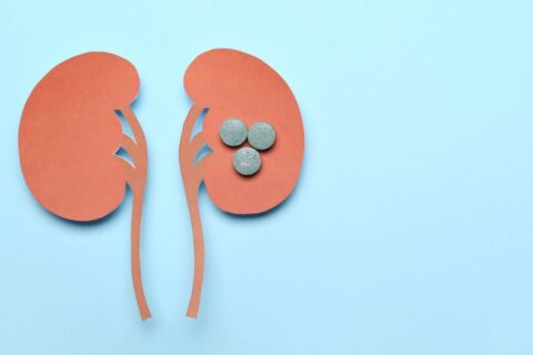 Perché si formano i calcoli renali - urologoandrologoraimoldi.it